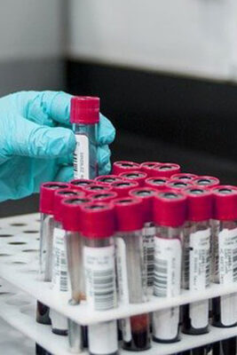 Laboratory Testing, Clinical Labs & Blood Draws ⋆ MedPhysicals Plus ...